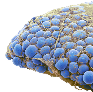 Steve Gschmeissner – Science Photo Library