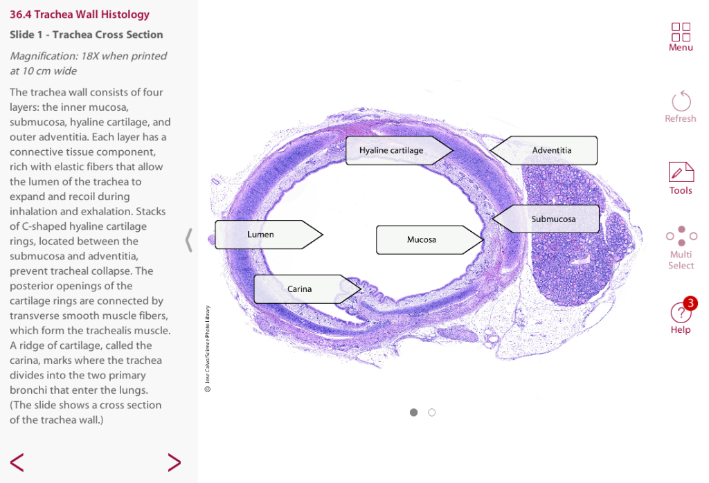 VISIBLE BODY – Science Photo Library