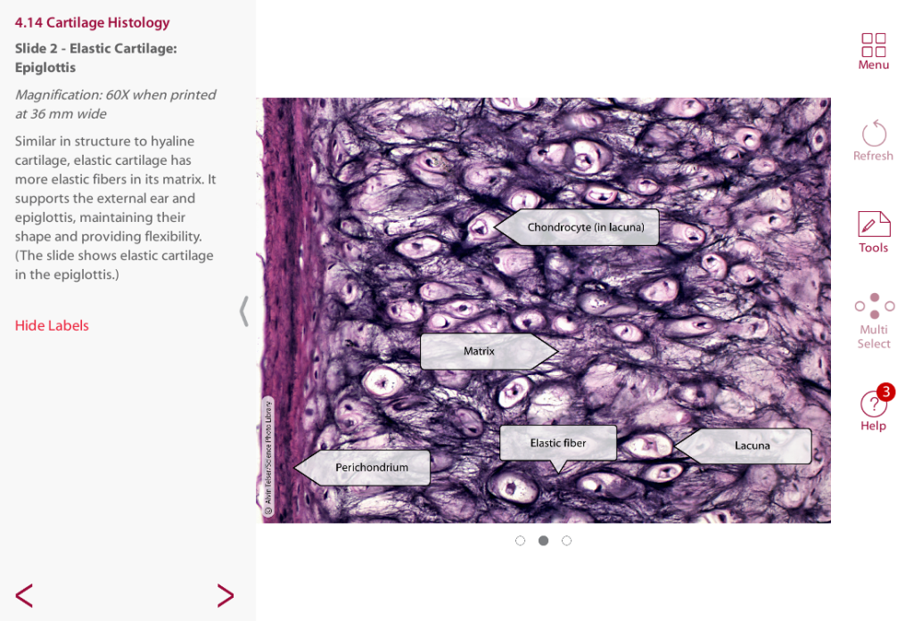 VISIBLE BODY – Science Photo Library