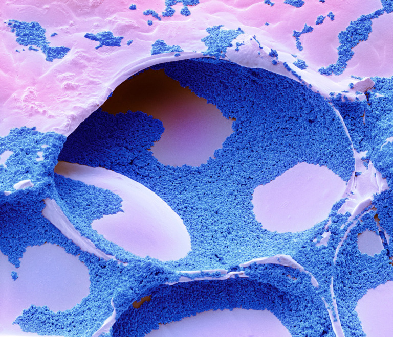 Lennart Nilsson Award – Winner 2021 – Science Photo Library