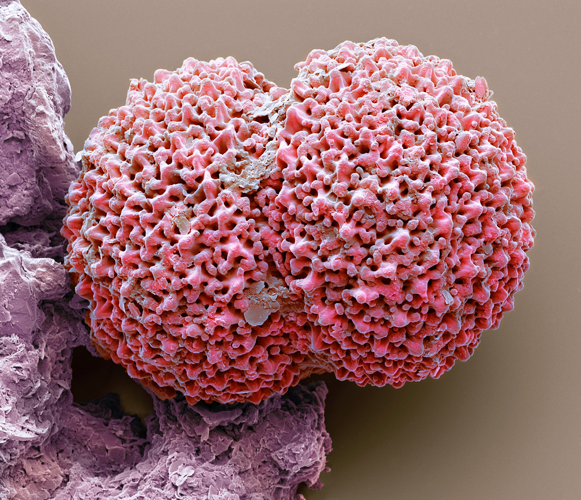 Lennart Nilsson Award – Winner 2021 – Science Photo Library