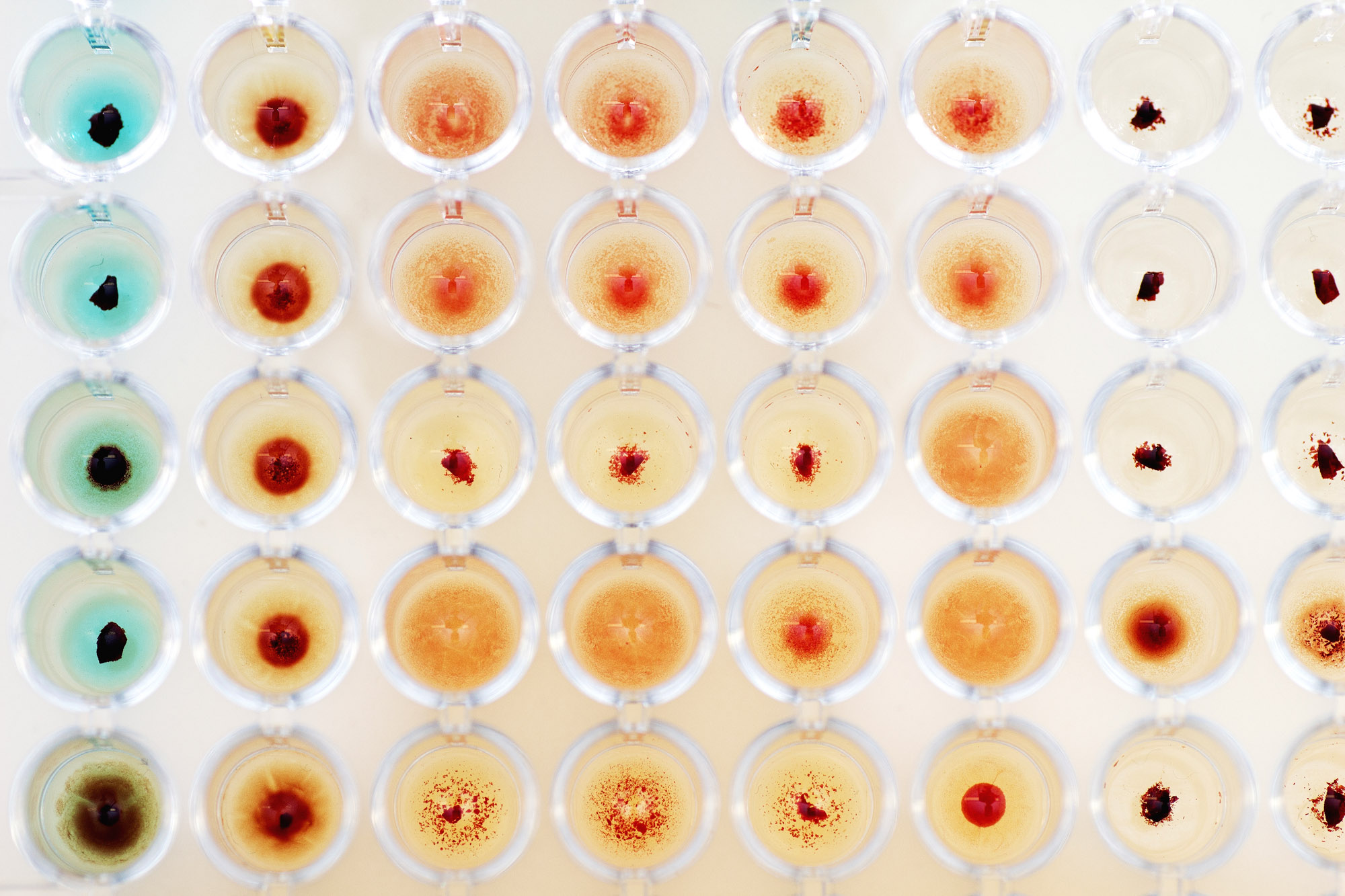BRITISH SOCIETY FOR HAEMATOLOGY – Science Photo Library