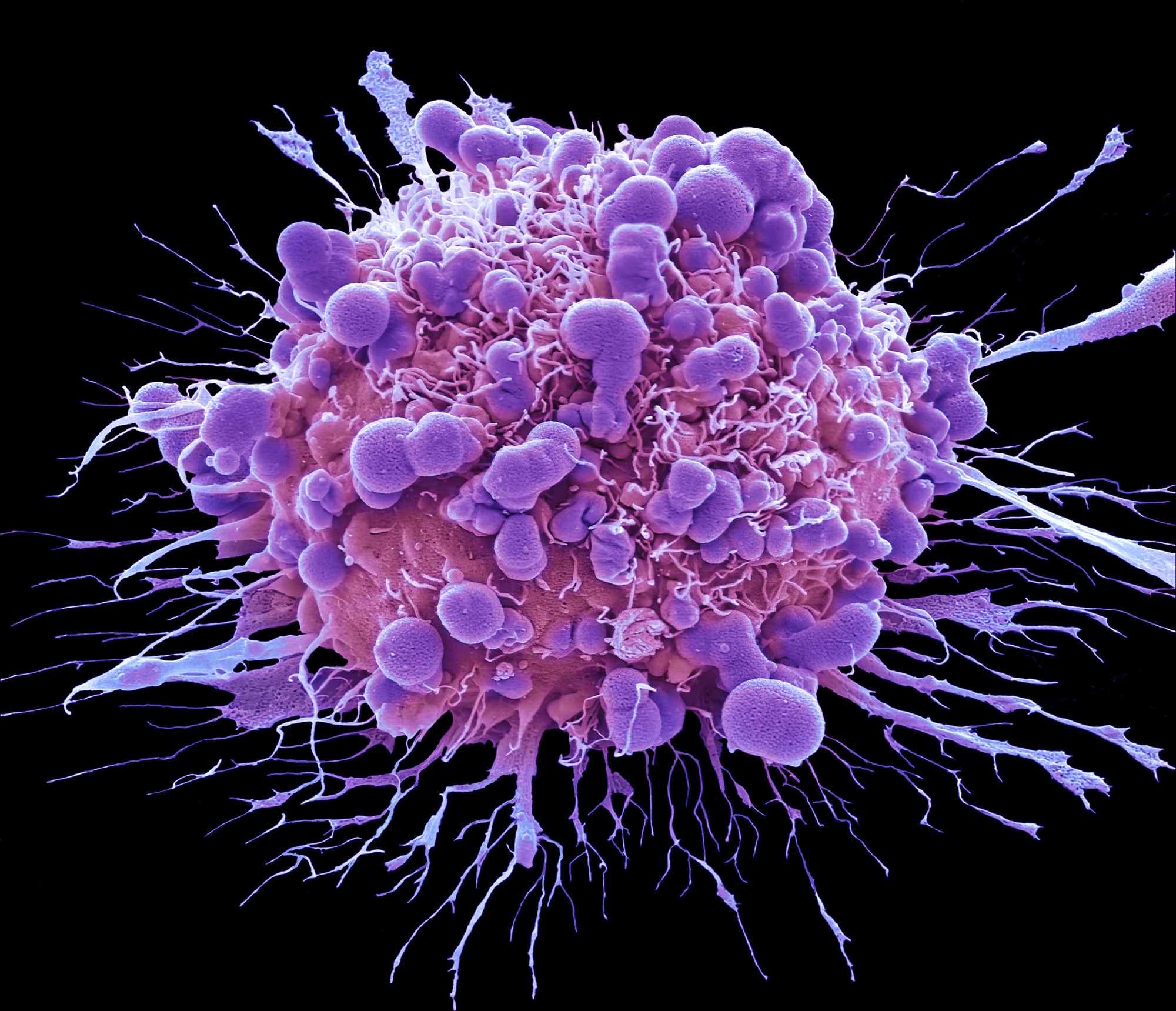 Cancer Cell Death – Science Photo Library