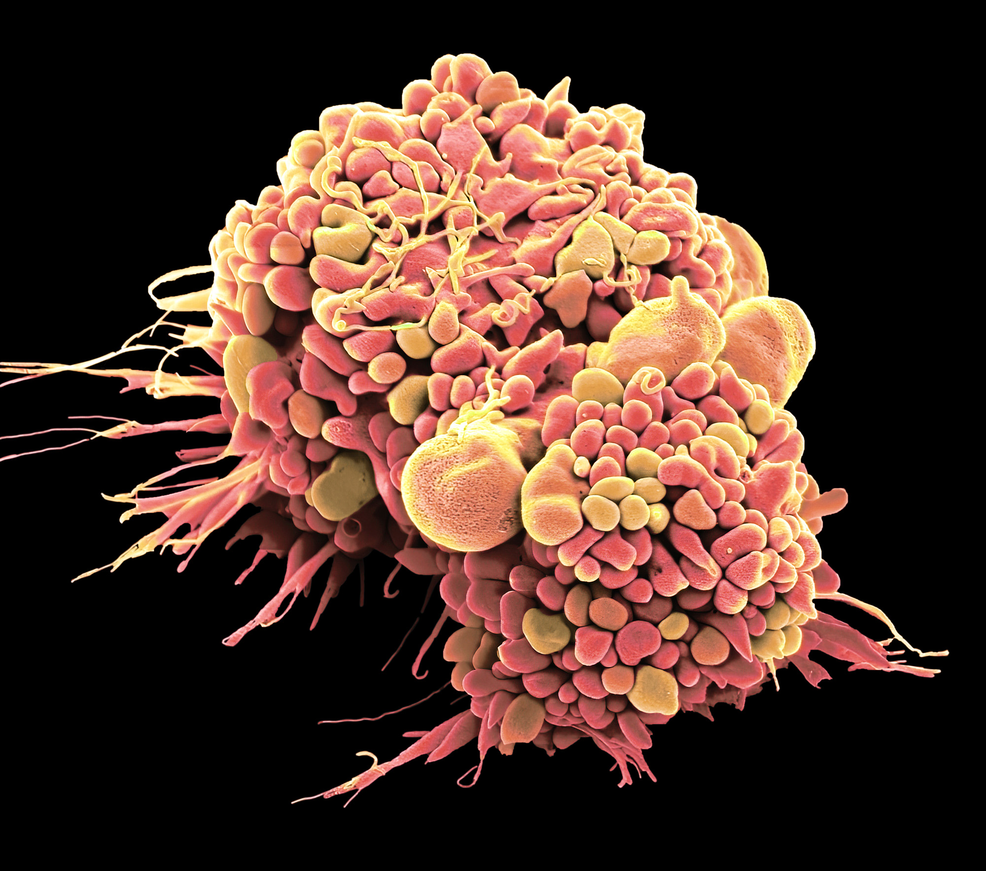 Cancer Cell Death – Science Photo Library