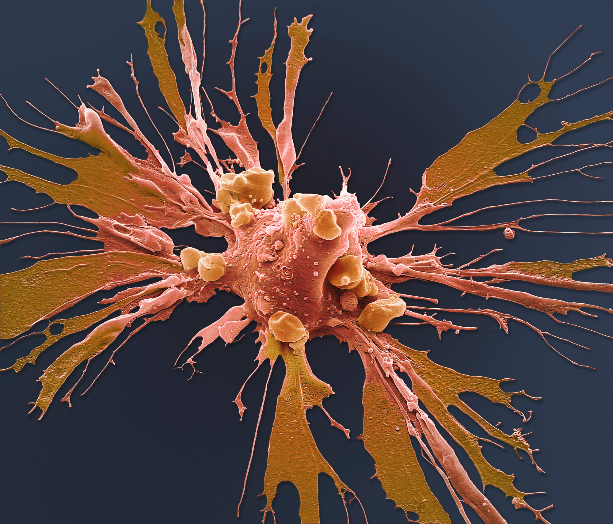 Cancer Cell Death – Science Photo Library