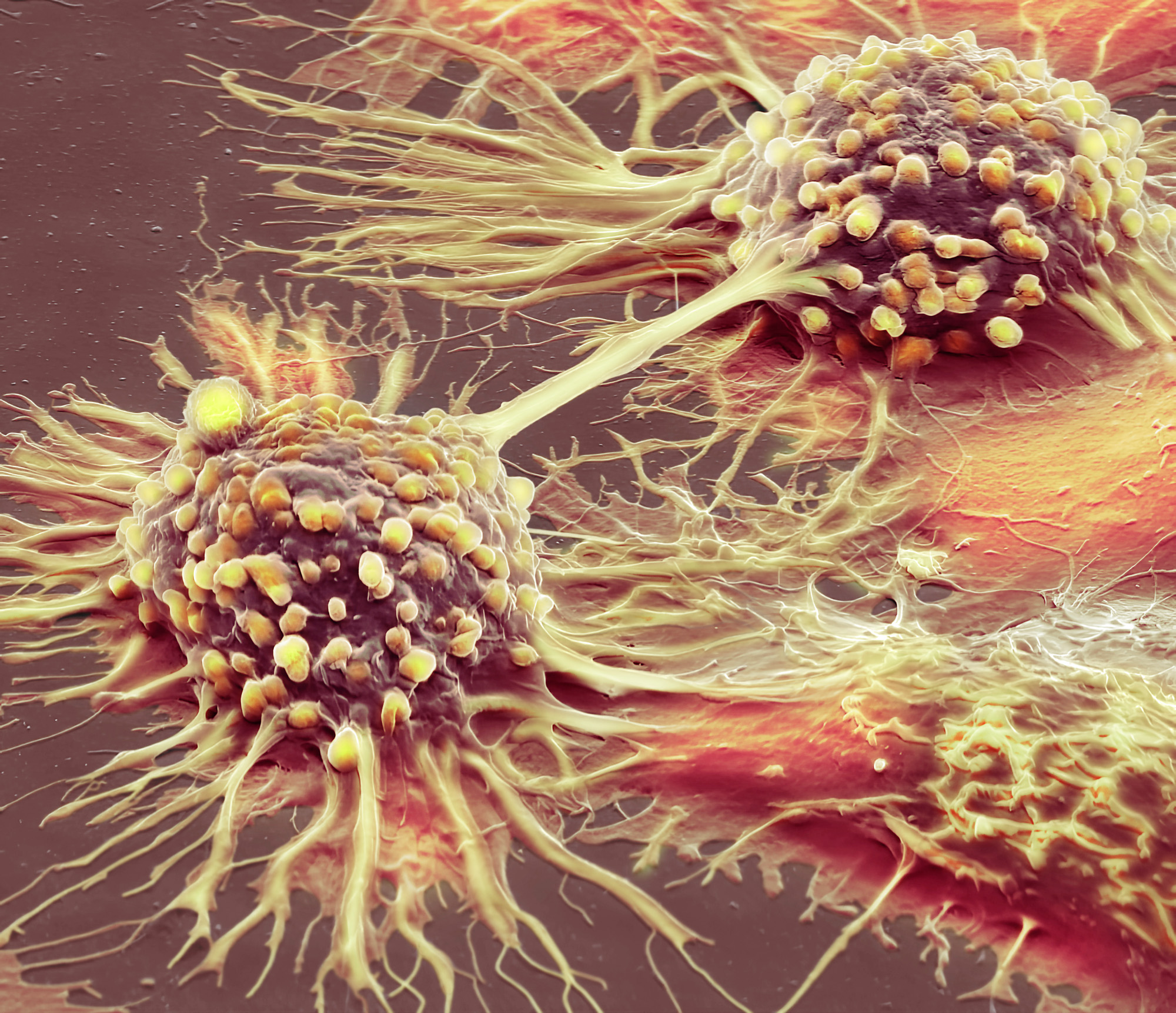 Cancer Cell Death – Science Photo Library