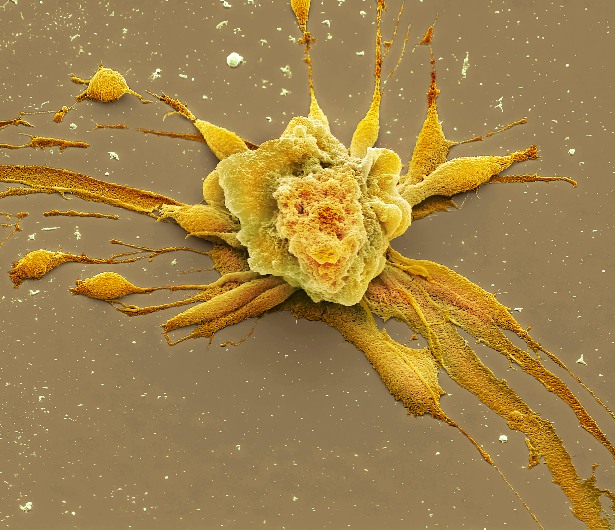 Cancer Cell Death – Science Photo Library