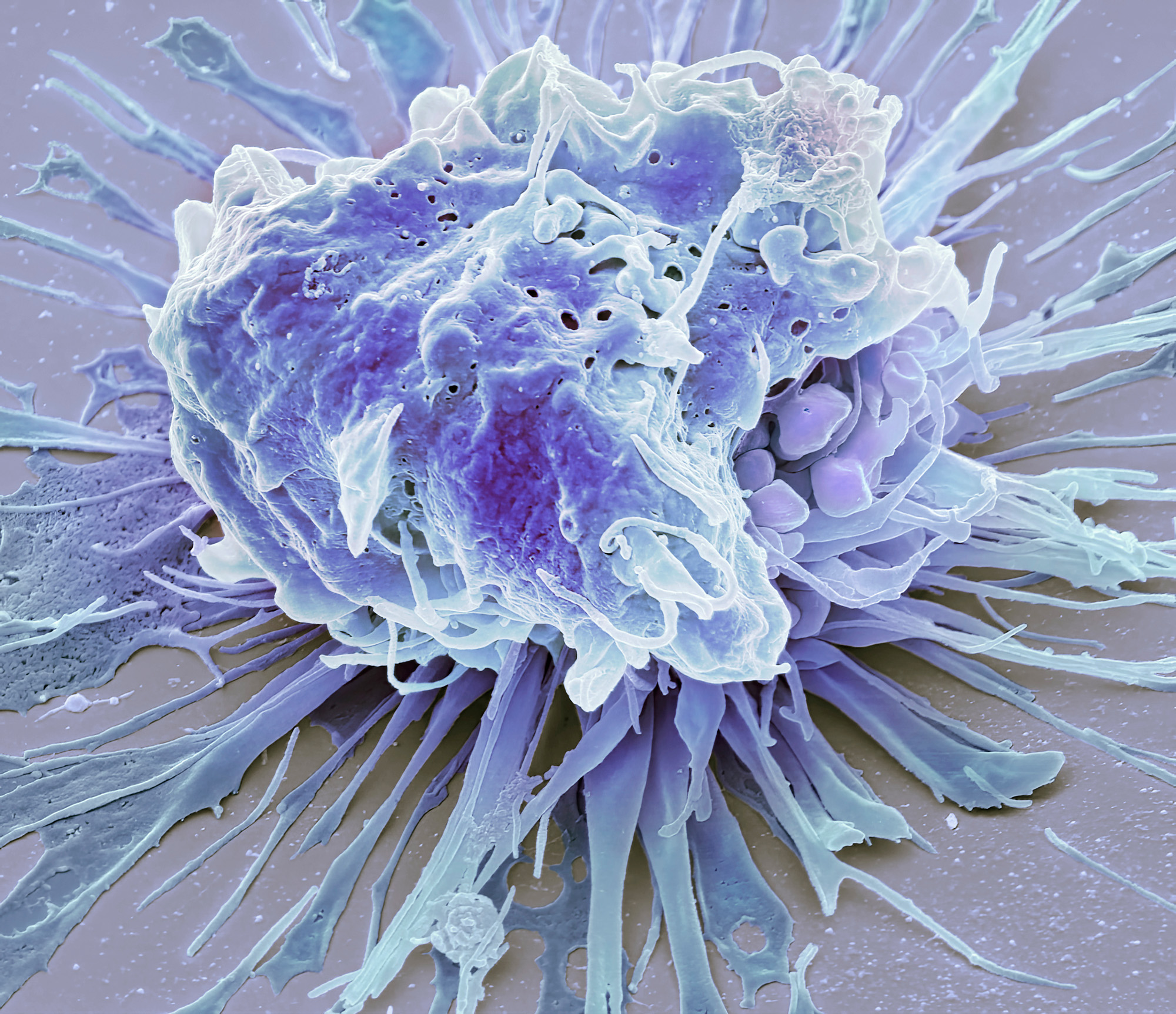 Cancer Cell Death – Science Photo Library