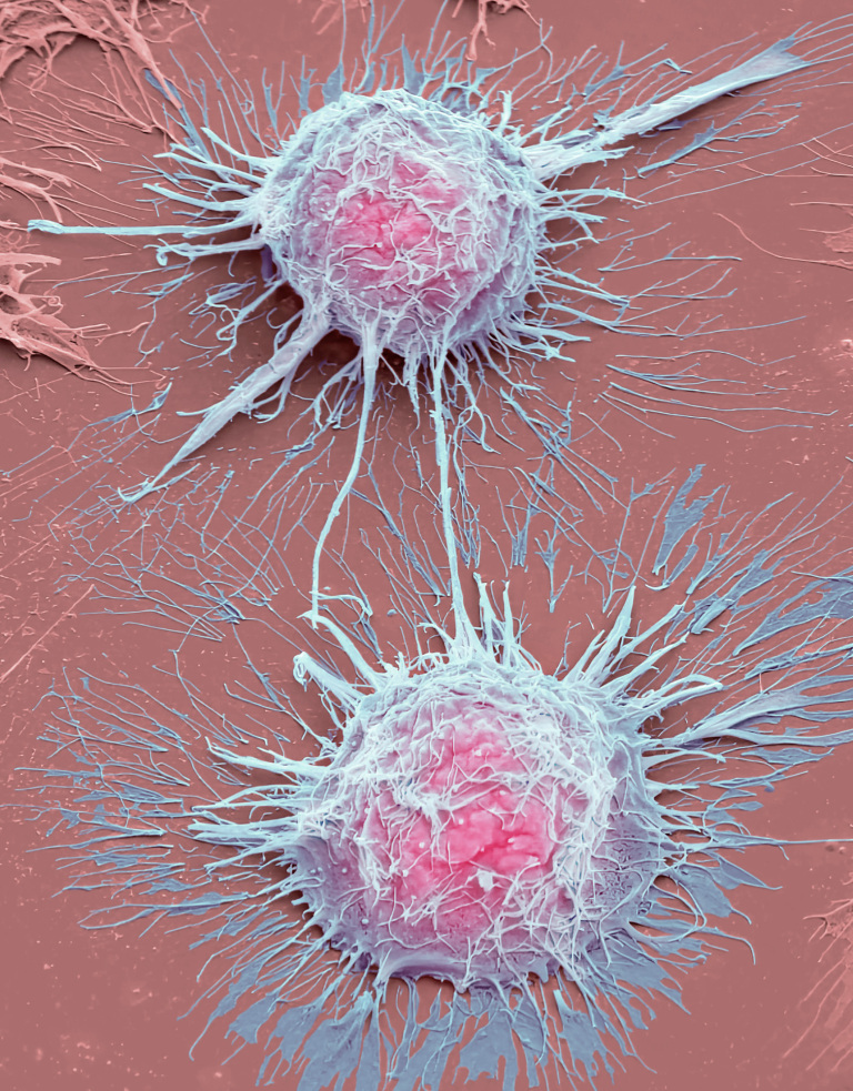 Cancer Cell Death – Science Photo Library