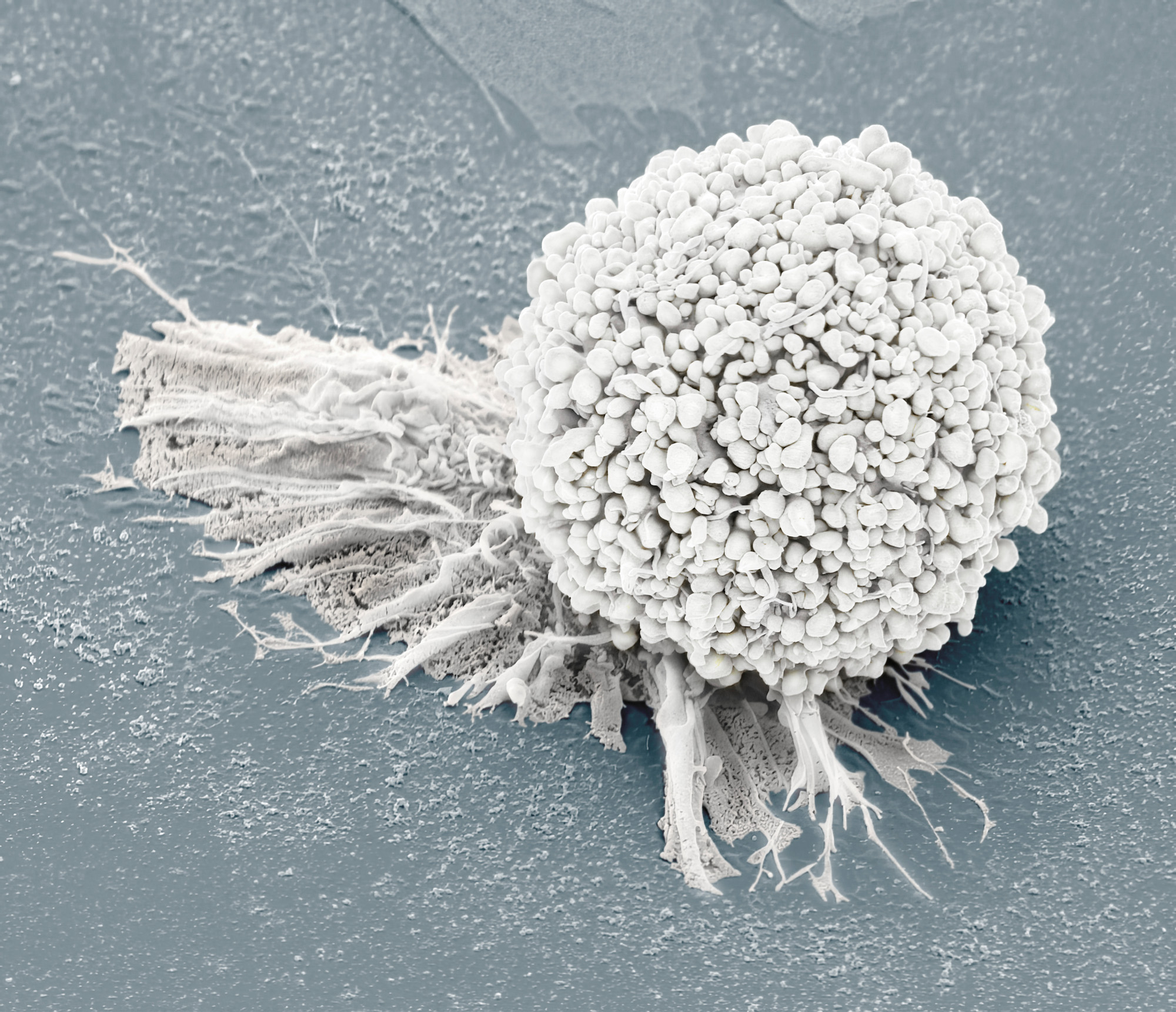 Cancer Cell Death – Science Photo Library