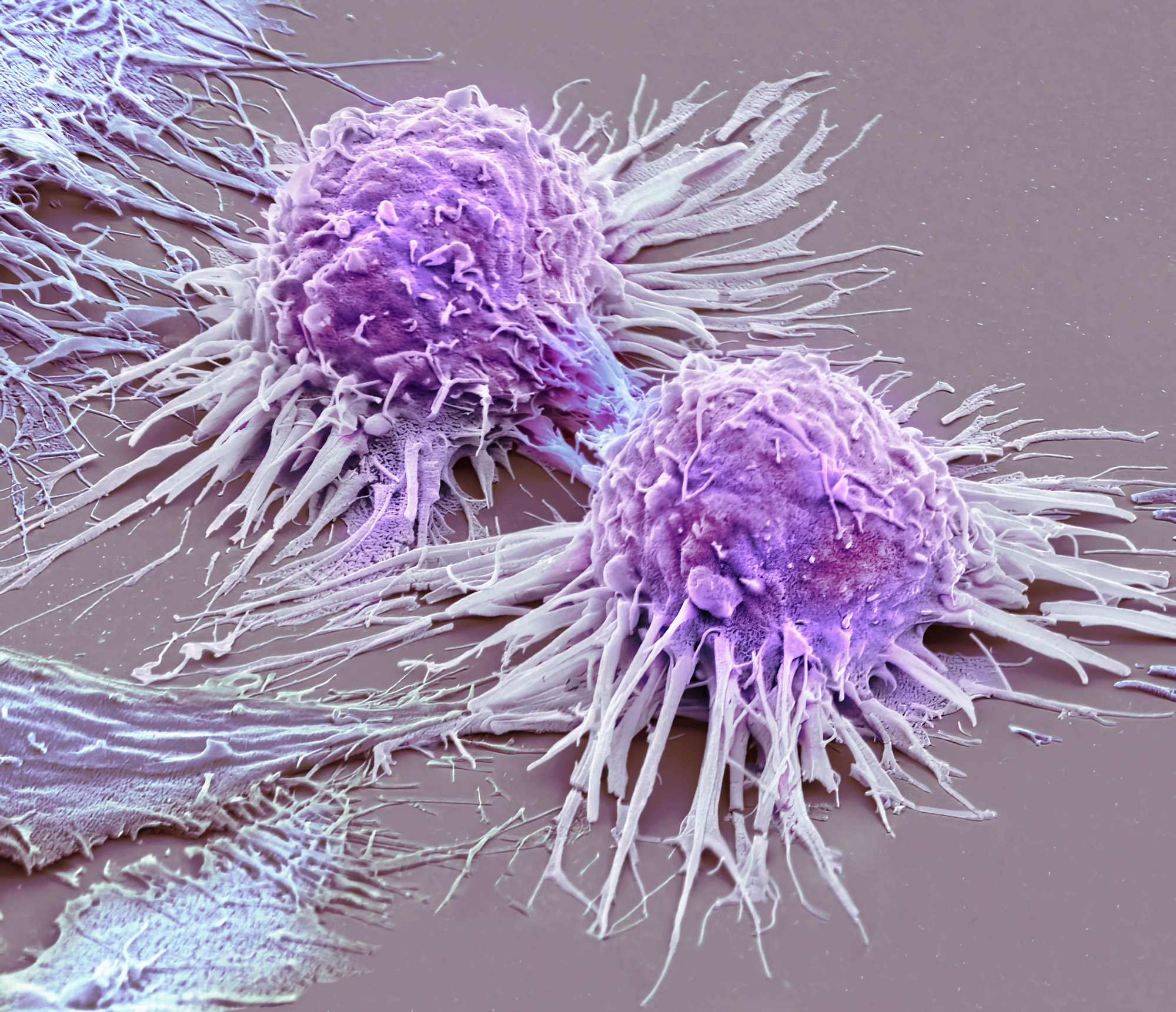 Cancer Cell Death – Science Photo Library